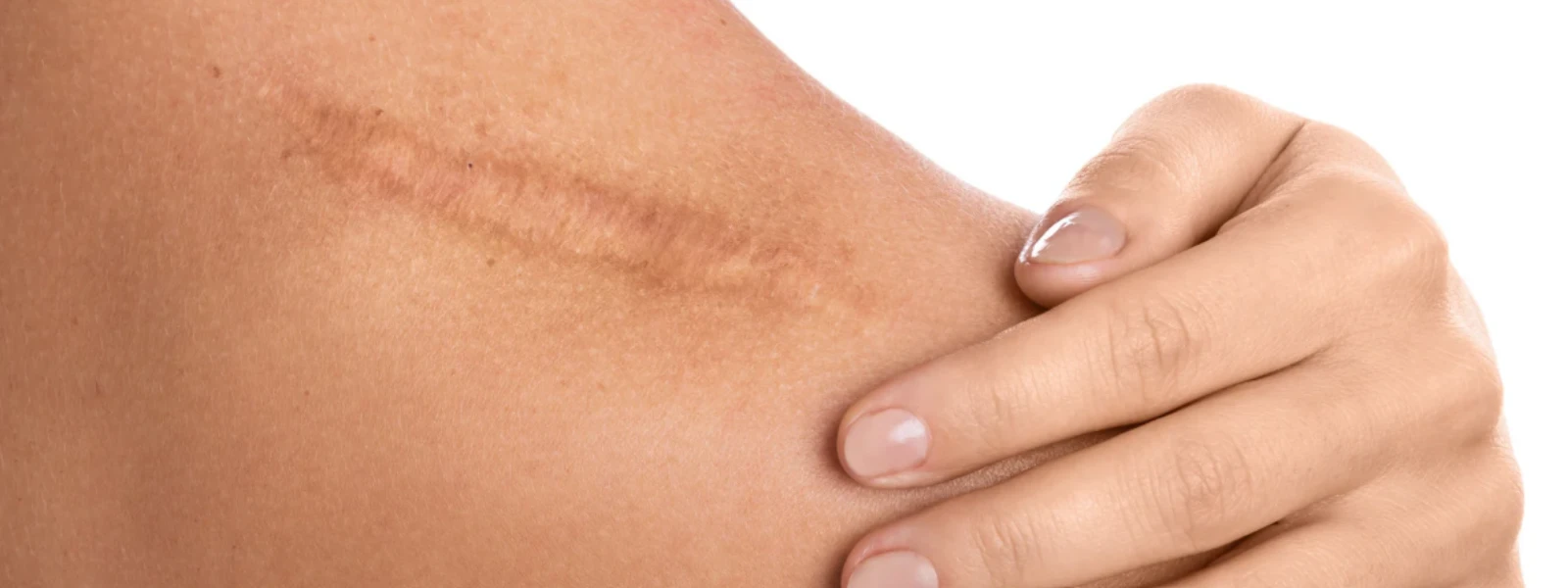 Essential Checklist: Scar Healing Strategies – World of Asaya