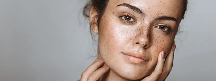 Treating Facial Skin Discoloration: A Complete Guide – World of Asaya