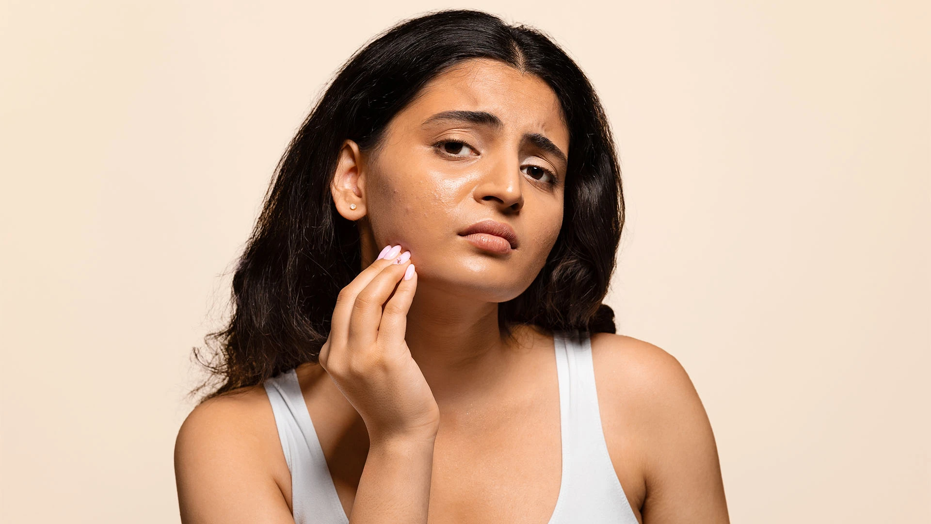 Ultimate Guide: Treating Acne on Oily Skin Step-by-Step – World of Asaya
