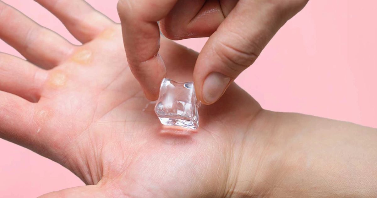How to Use an Ice Roller for Face: A Beginner's Guide
