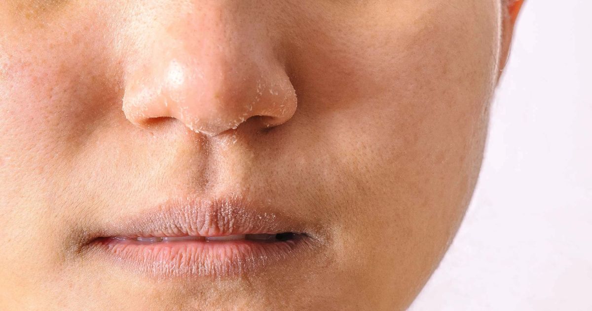 Step-by-Step: Choosing the Best Face Serum for Dry Skin