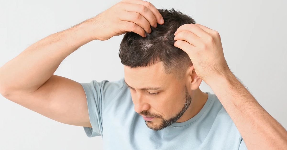 Checklist: Does Hair Color Lead to Premature Grey Hair?